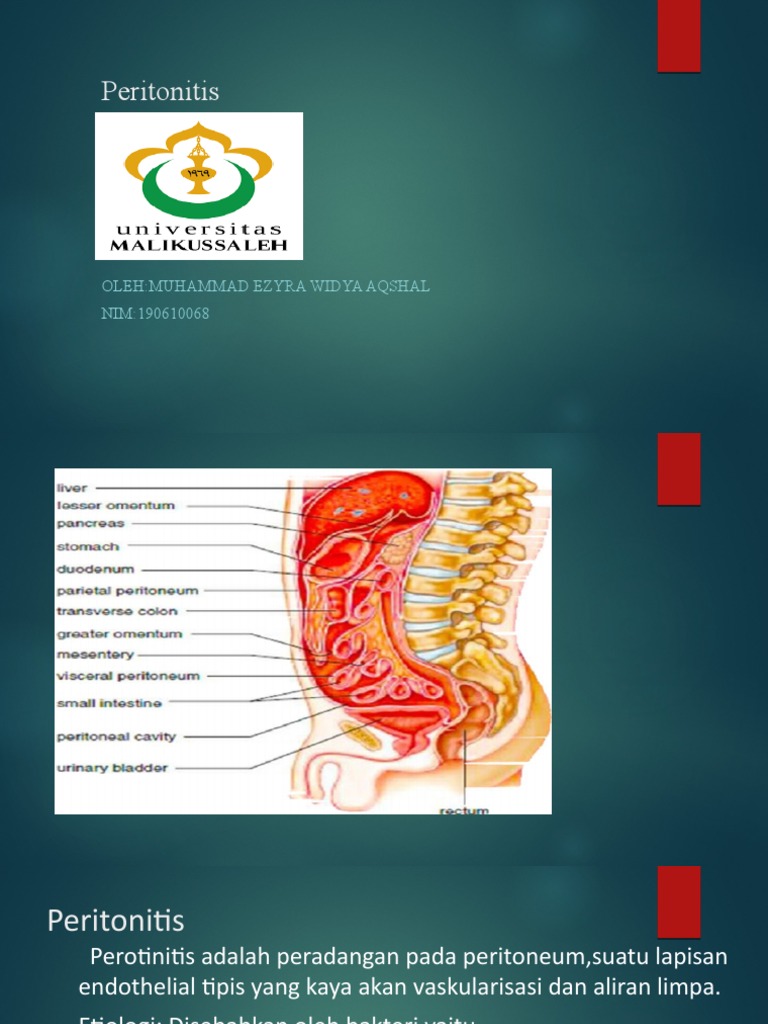 Peritonitis | PDF