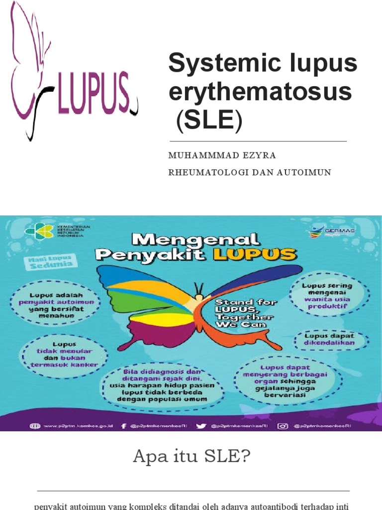 Systemic Lupus Erythematosus (SLE) | PDF