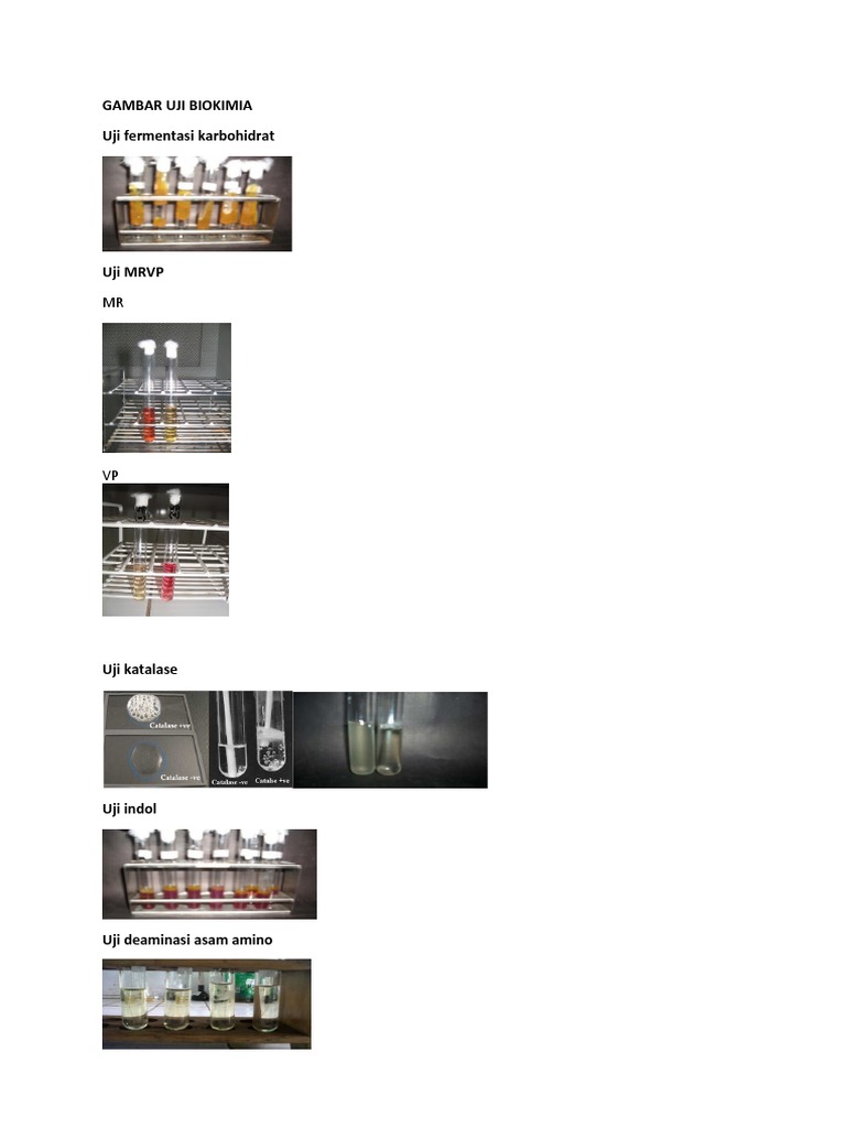 Gambar Uji Biokimia | PDF
