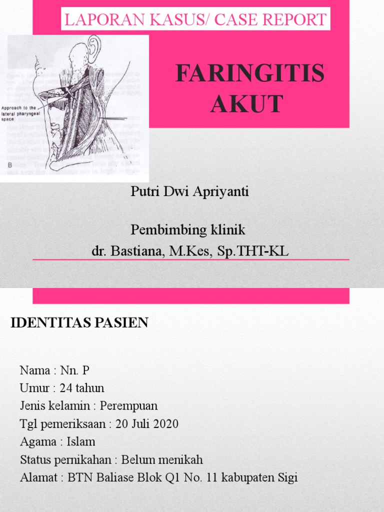 Faringitis Akut | PDF