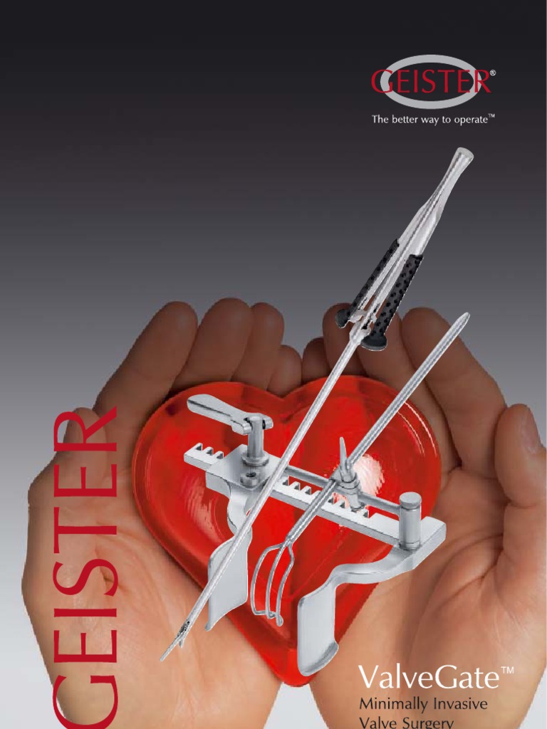 Valvegate | PDF | Surgery | Medical Specialties