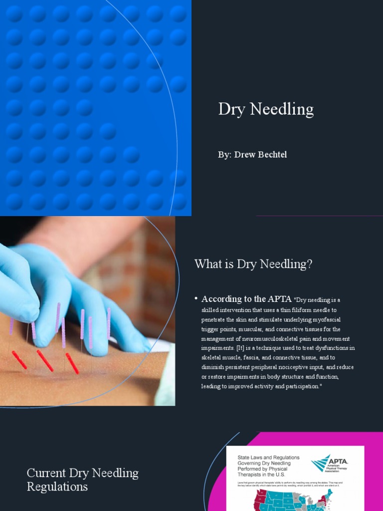 Dry Needling | PDF | Myofascial Trigger Point | Symptoms And Signs: General