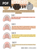 Clasificación de Seibert Los Defectos Del Reborde Alveolar | PDF