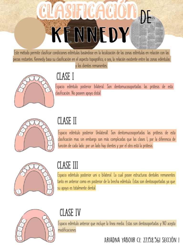 Kennedy Clasificacion | PDF
