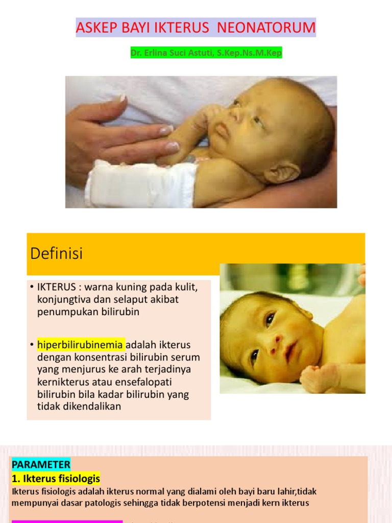 Penanganan Ikterus Neonatorum pada Bayi | PDF