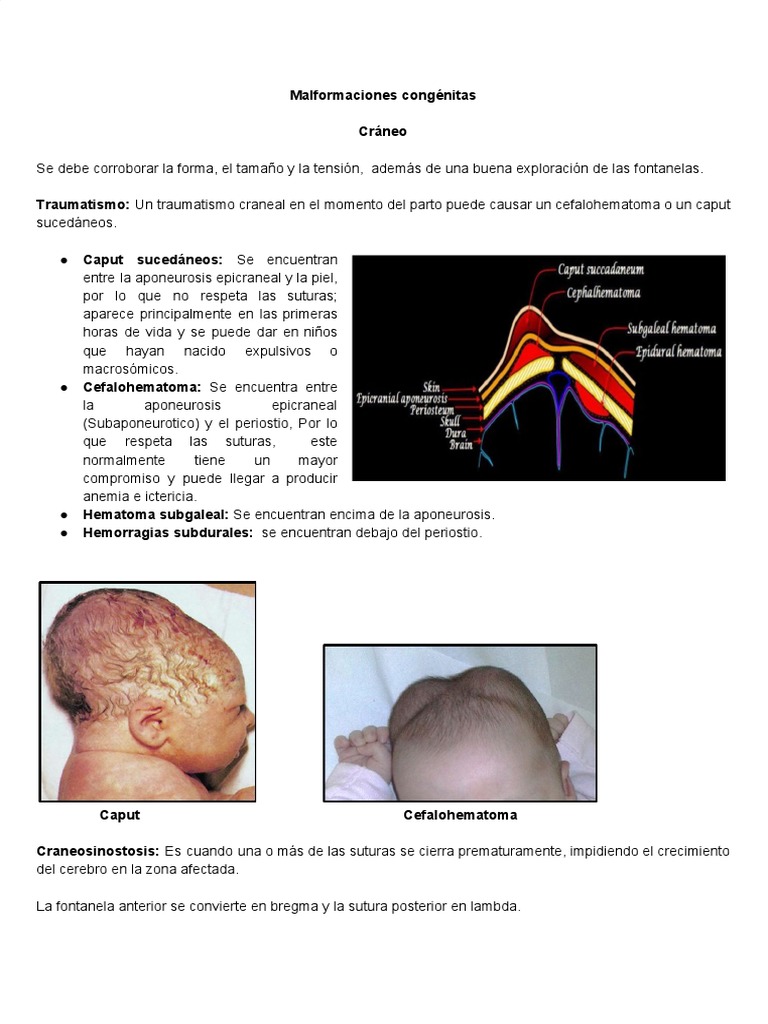 Malformaciones Congénitas - Dra. Zulmir | PDF | Cráneo | Medicina CLINICA