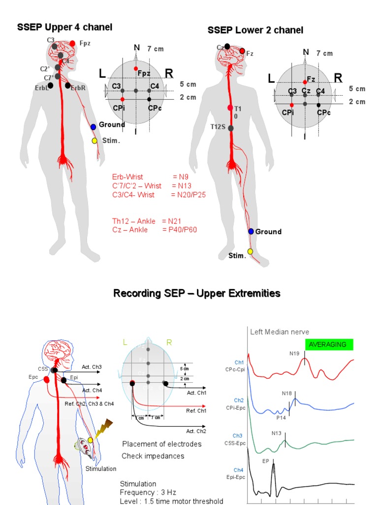 L R L R: SSEP Lower 2 Chanel SSEP Upper 4 Chanel | PDF | Nervous System ...