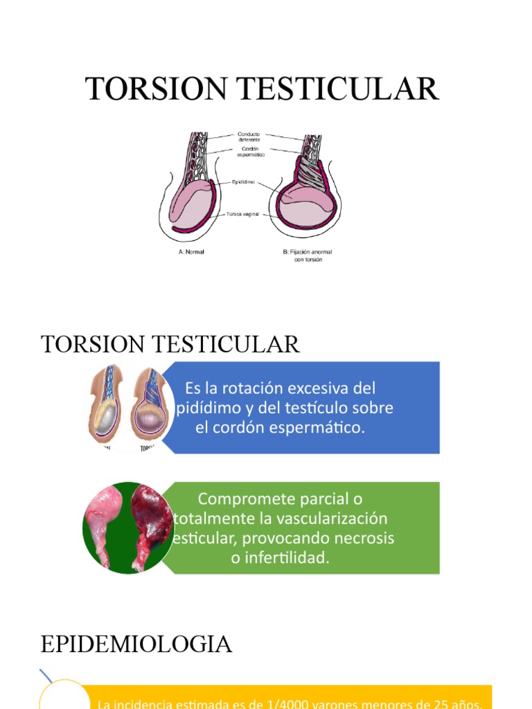 Torsion Testicular | PDF | Enfermedades y trastornos humanos ...