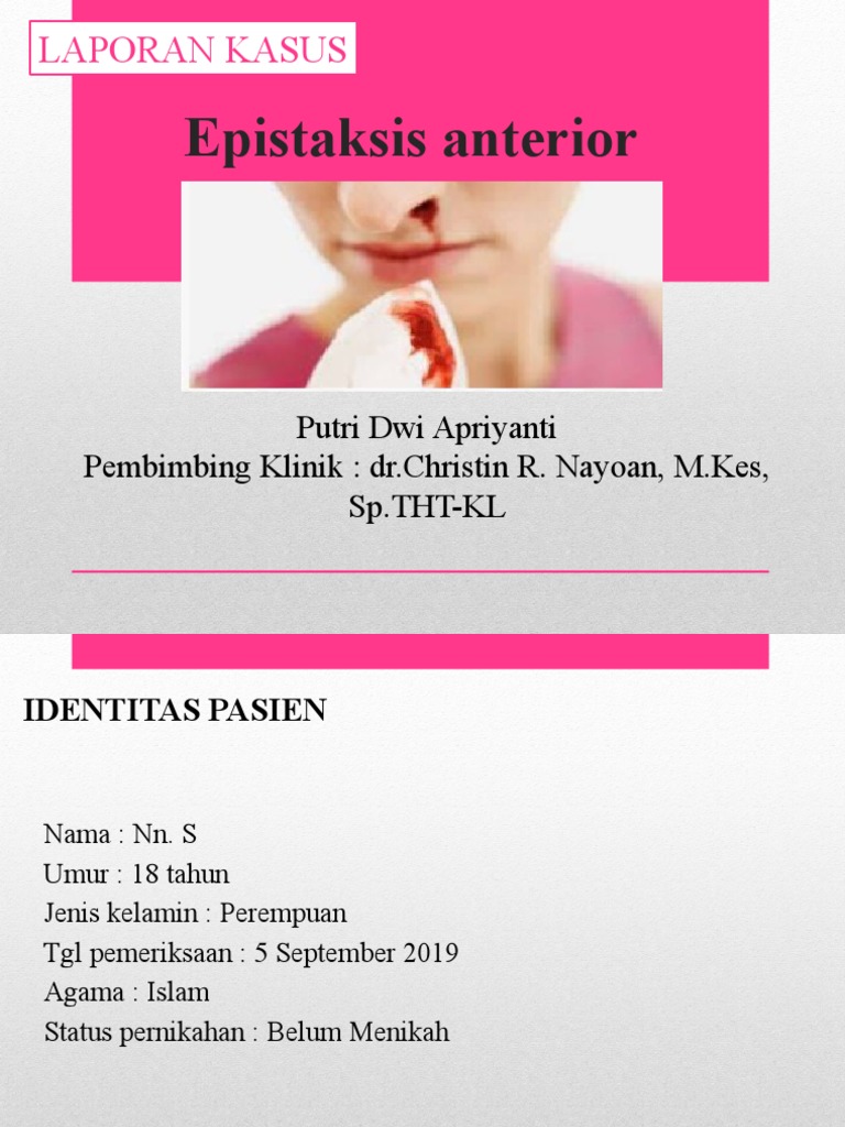 Epistaksis Anterior | PDF