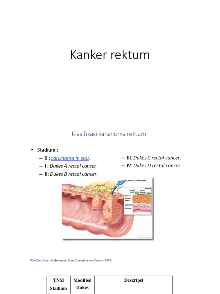 Kanker Rektum | PDF
