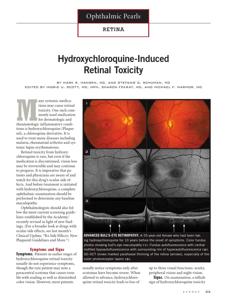 Hydroxychloroquine-Induced Retinal Toxicity: Ophthalmic Pearls | PDF ...