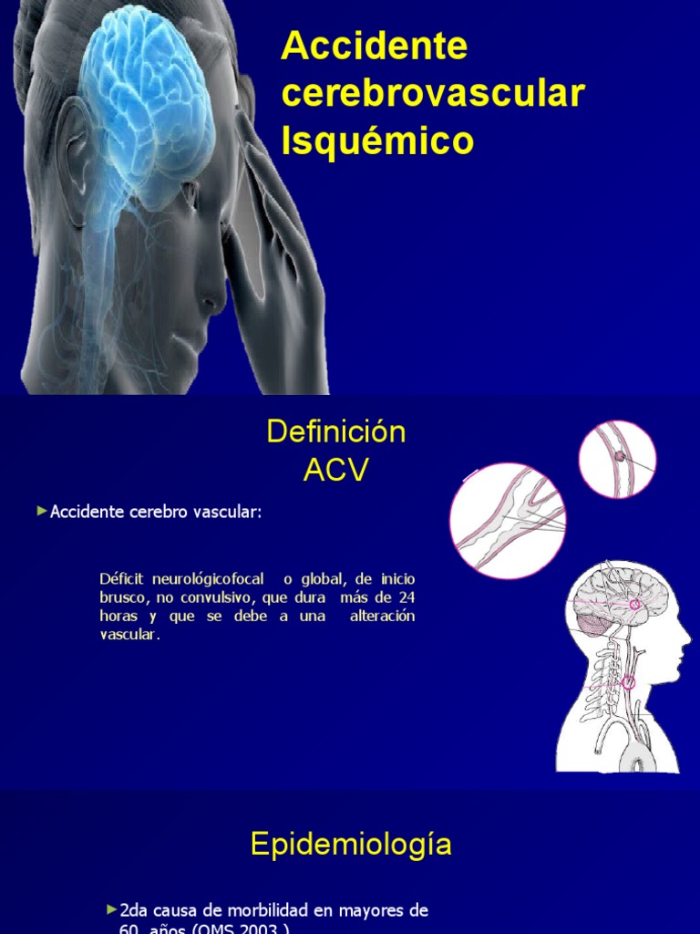 Acv Isquemico | PDF | Carrera | Enfermedades y trastornos humanos