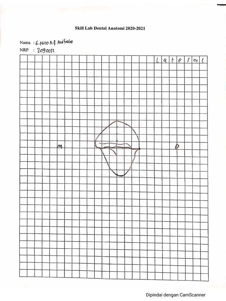 Gregorius Nico Arya Putra Naibaho Gambar Incisivus Central Lateral ...