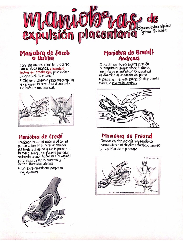 Maniobras Placentarias | PDF
