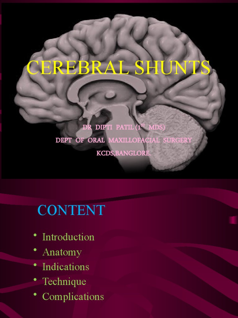 Cerebral Shunts: DR Dipti Patil (1 MDS) Dept of Oral Maxillofacial ...