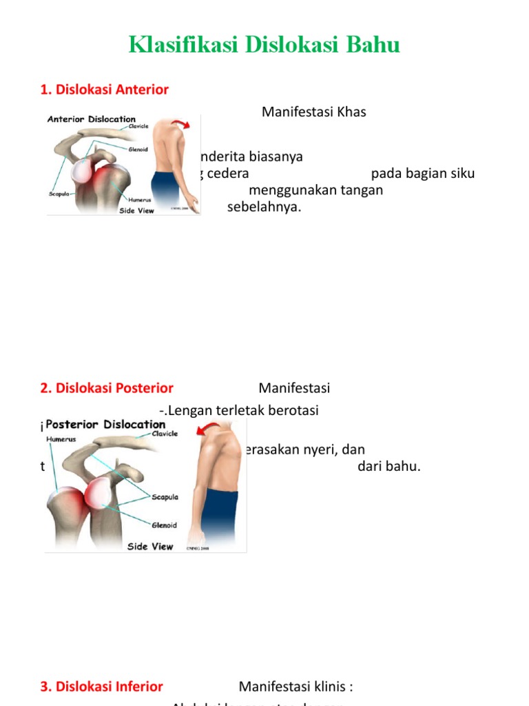 Klasifikasi Dislokasi Bahu LI 6 | PDF