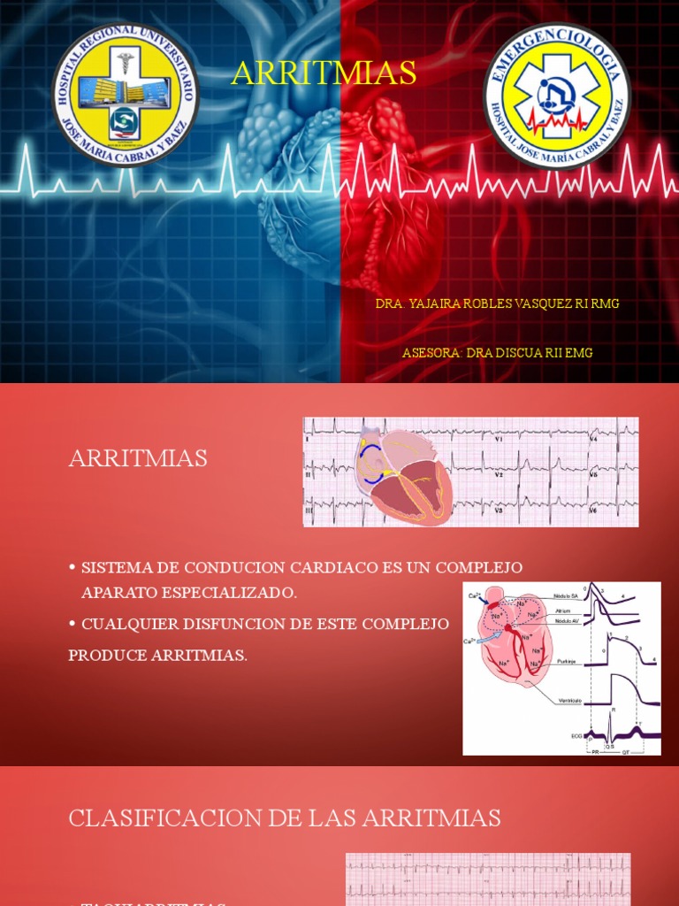 Clasificación y Tratamiento de Arritmias | PDF | Arritmia cardiaca ...