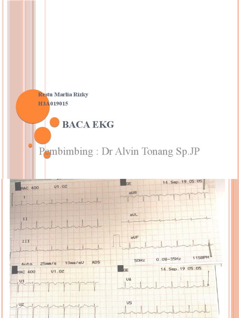 Baca Ekg | PDF | Kesehatan Holistik