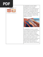 Anatomía y disección de la arteria mamaria interna | PDF | Tórax | Aorta