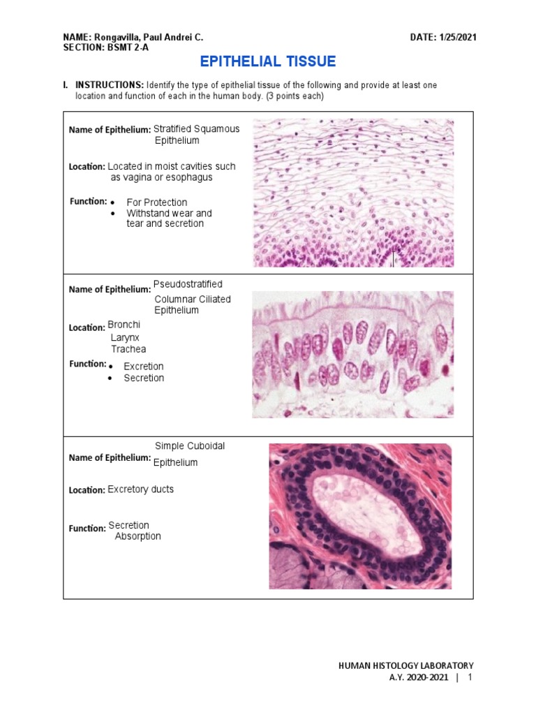 Epithelial Tissue: Name of Epithelium: Stratified Squamous | PDF ...
