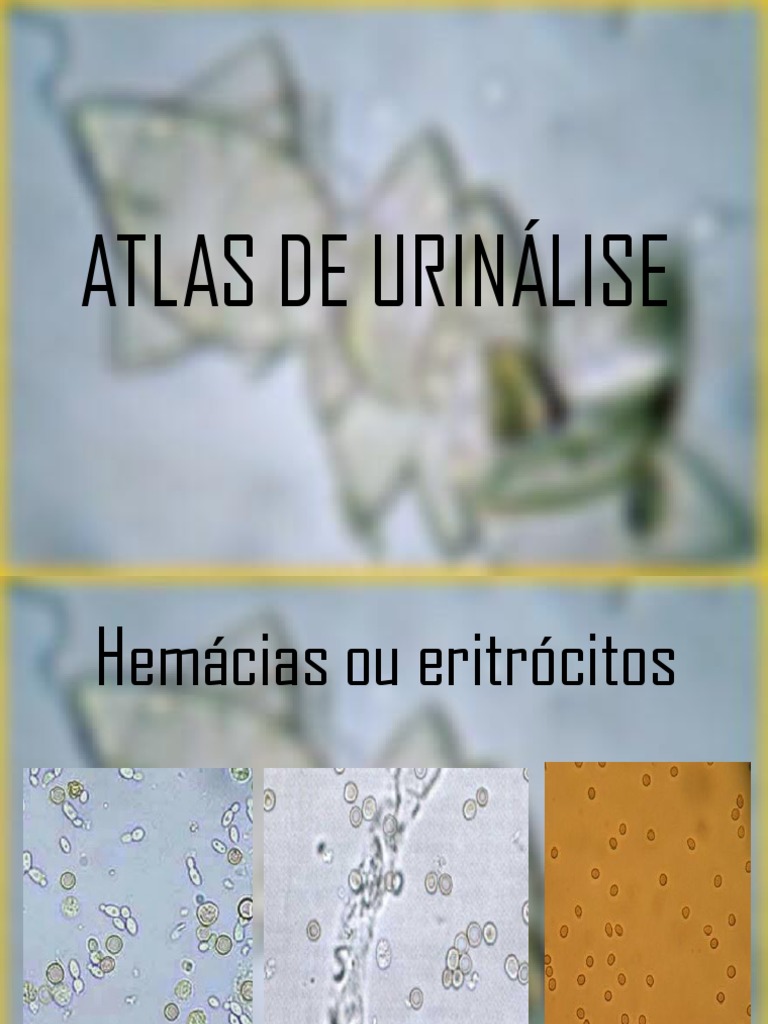 Atlas de Urinálise Completo | PDF