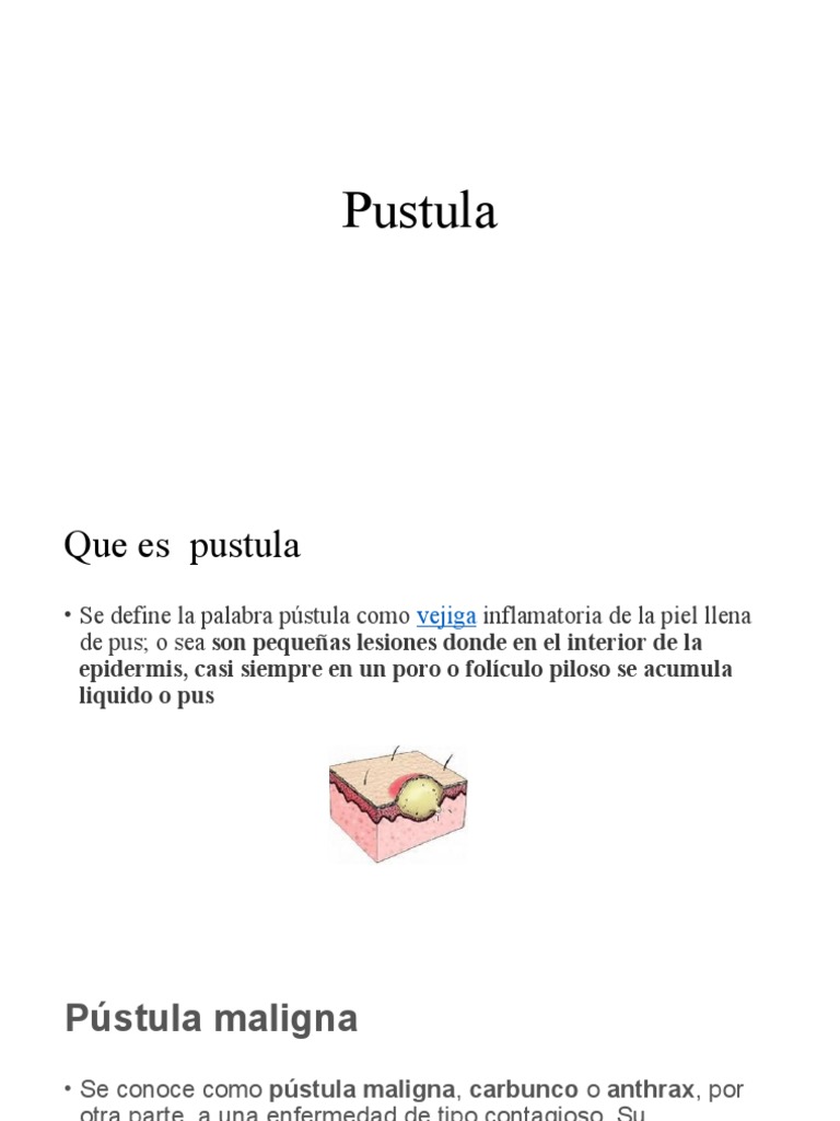 Pustula | PDF