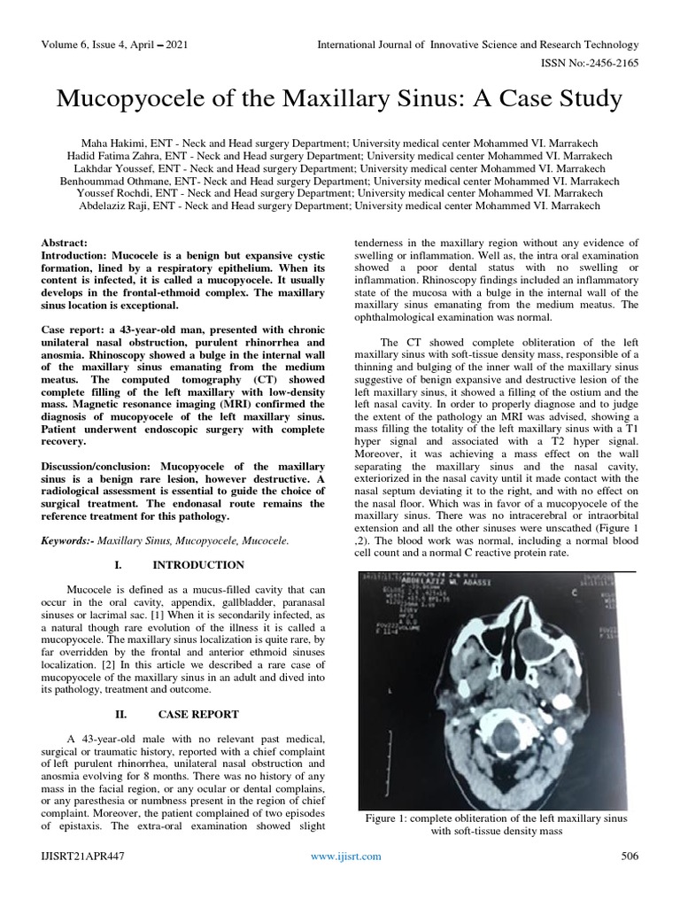 Mucopyocele of The Maxillary Sinus A Case Study | PDF | Magnetic ...