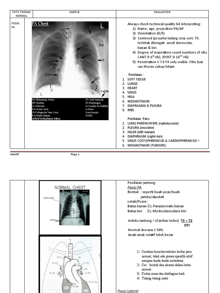 Evaluasi Foto Thorax Normal | PDF