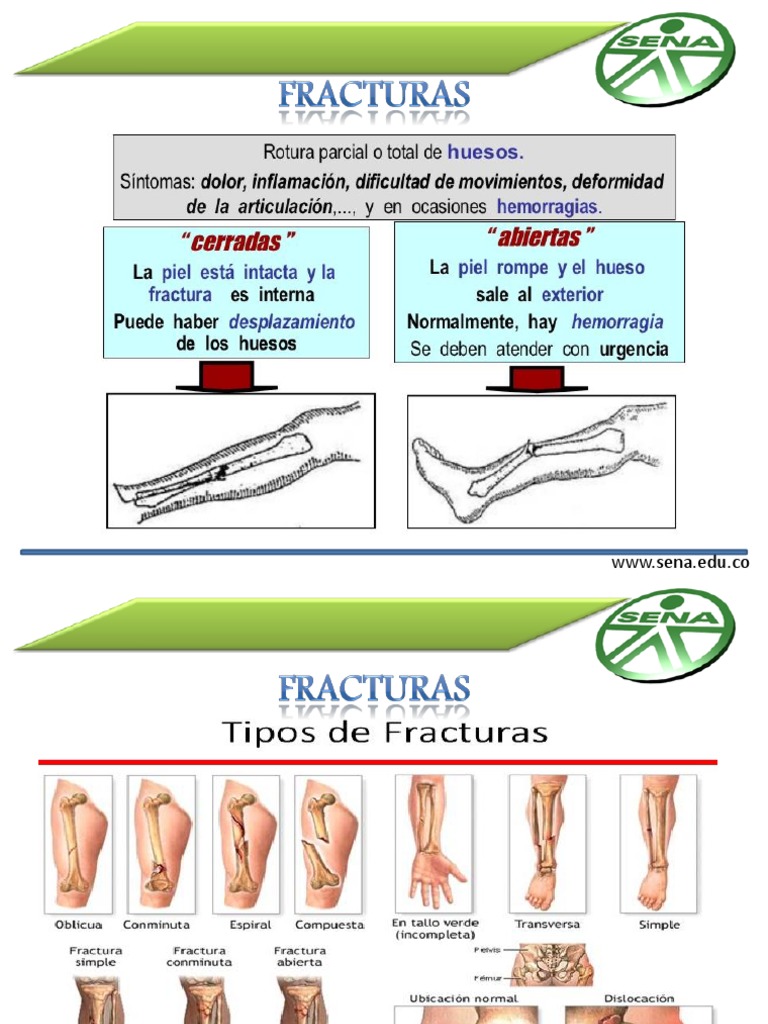 Fracturas Oseas Pdf