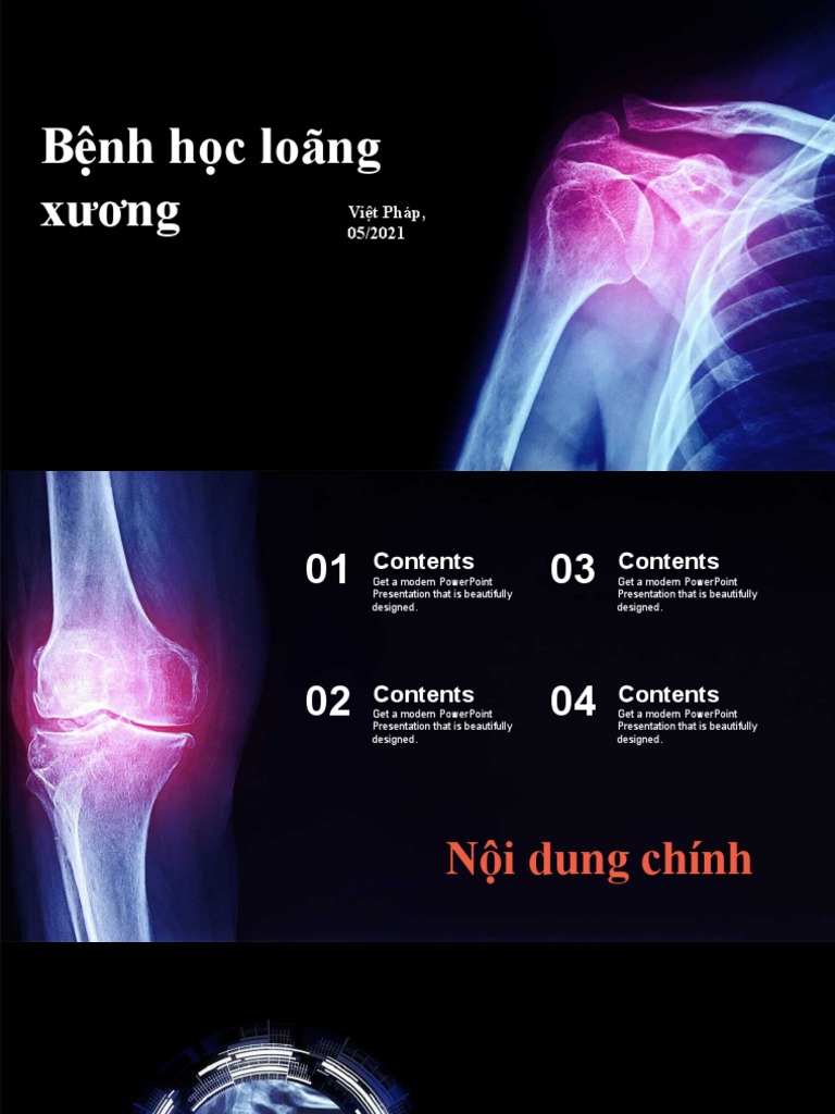 Medical Orthopedic PowerPoint Templates | PDF | Infographics ...