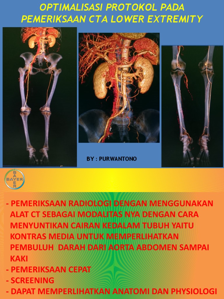 Webinar Cta Lower Extremity | PDF