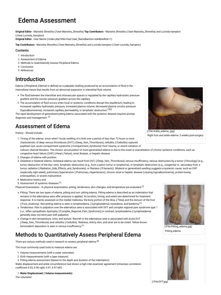 Edema Assessment - Physiopedia | PDF | Edema | Medical Specialties