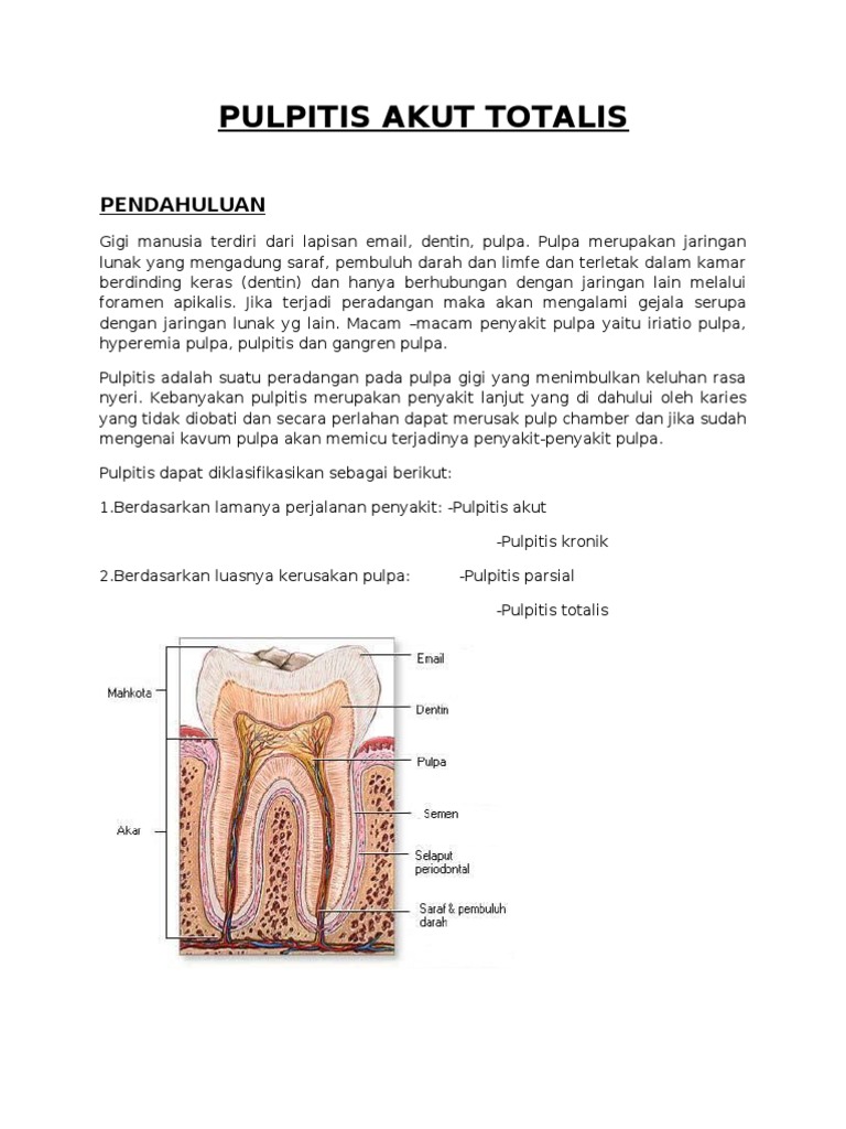 PULPITIS AKUT TOTALIS: PENYAKIT PERADANGAN PULPA GIGI YANG MENYELURUH | PDF