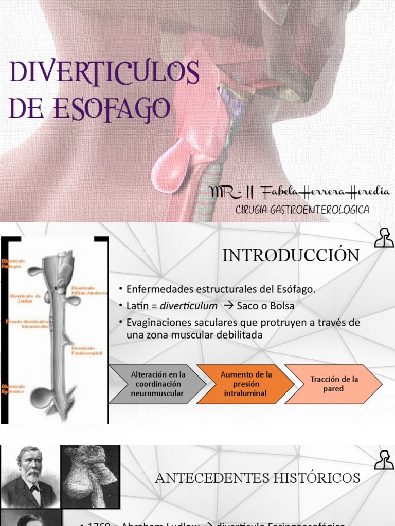 Diverticulos de Esofago | PDF | Enfermedades digestivas | Gastroenterología