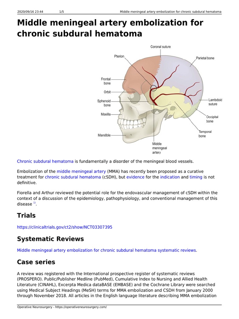 2020middle Meningeal Artery Embolization For Chronic Subdural Hematoma ...