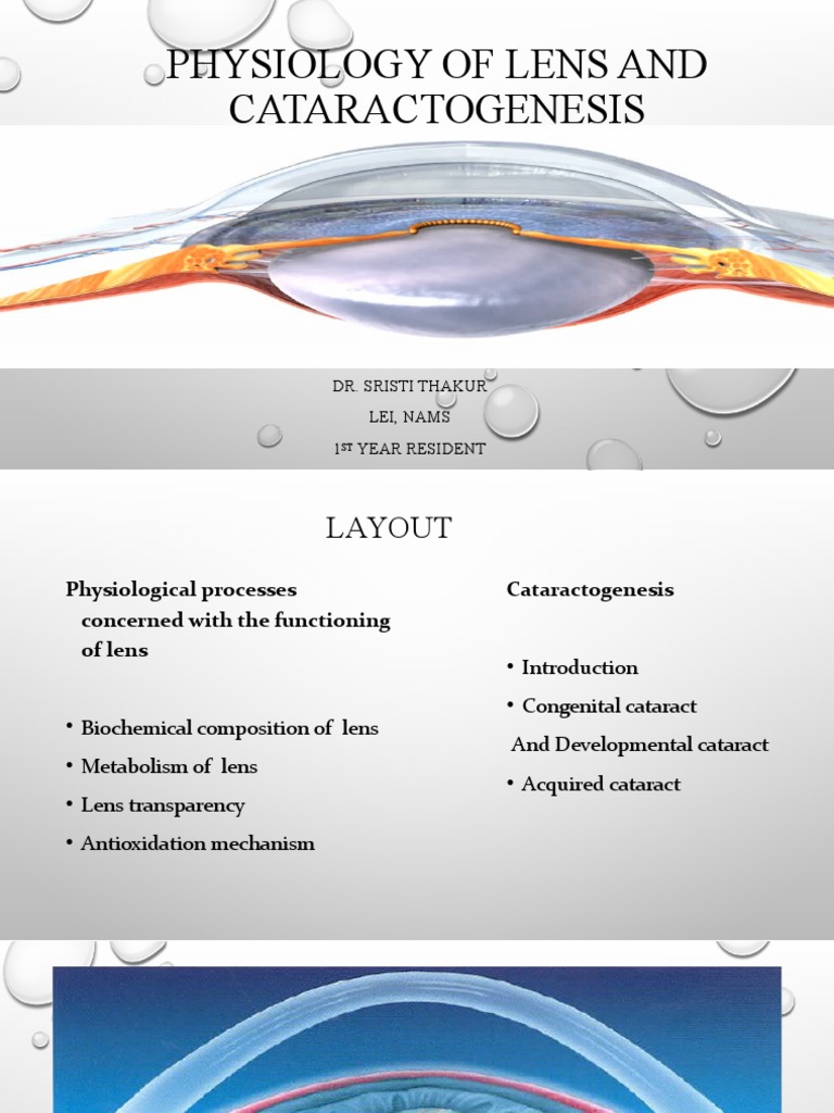 92.physiology of Lens and Cataractogenesis... Sris | PDF | Cataract ...