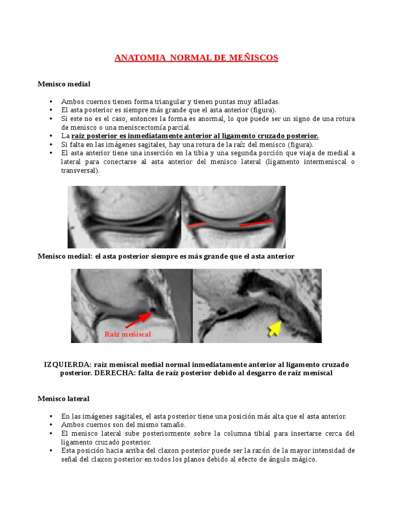 Anatomía y Desgarros del Menisco | PDF | Articulaciones | Sistema ...
