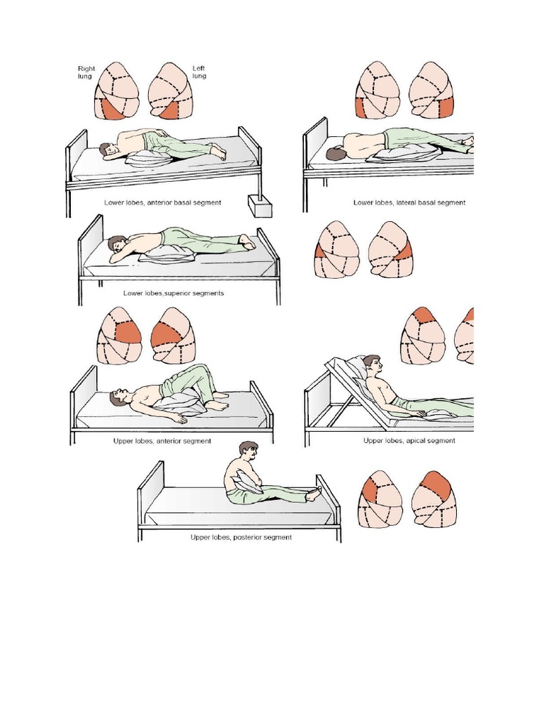 Posisi Fisioterapi Dada | PDF