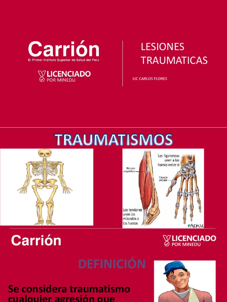 Clase 4 Lesiones Traumaticas.. | PDF | Lesión | Hueso