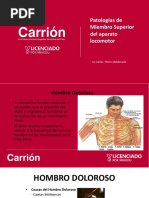 Mano de Predicador | PDF | Mano | Anatomía humana