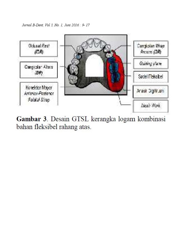 Desain GTSL Kerangka Logam | PDF