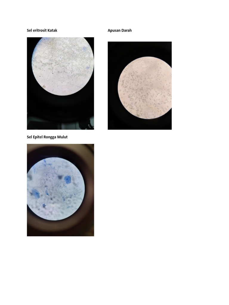 Sel Eritrosit Katak Apusan Darah Wawa | PDF