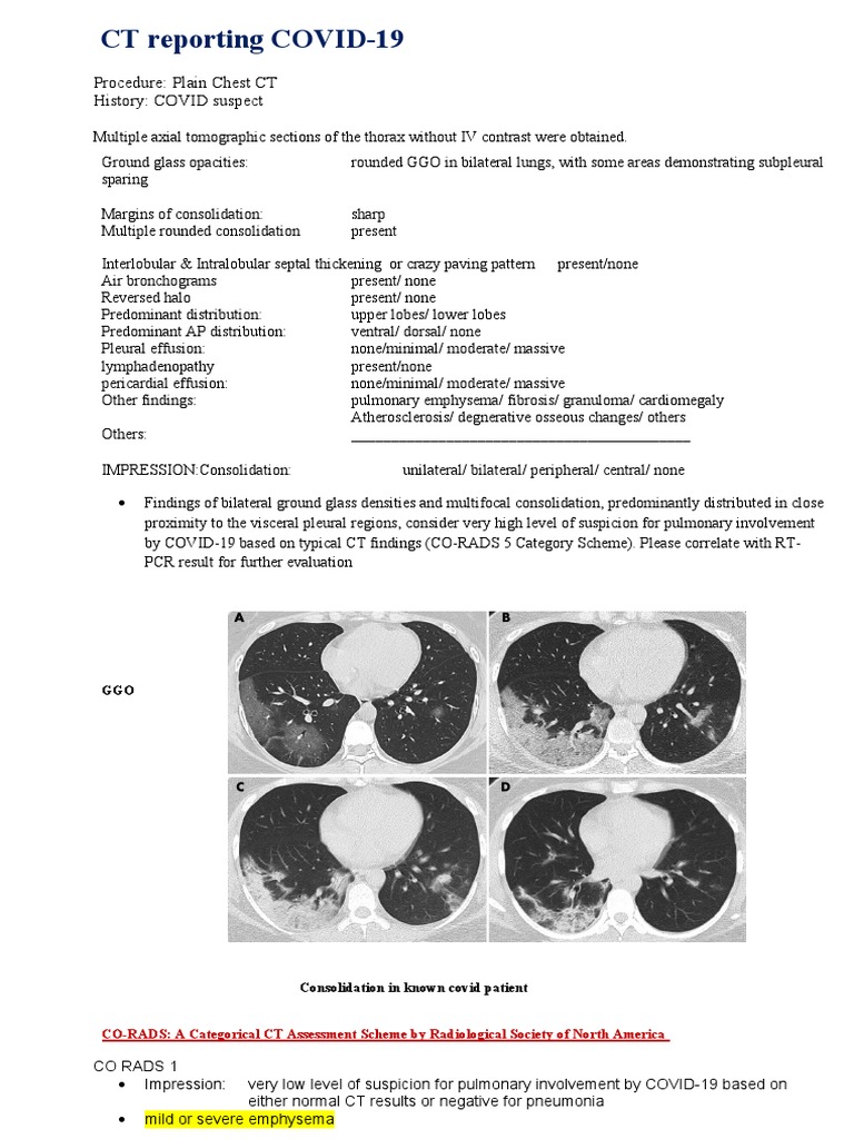 Chest CT Covid Template | PDF | Pneumonia | Lung