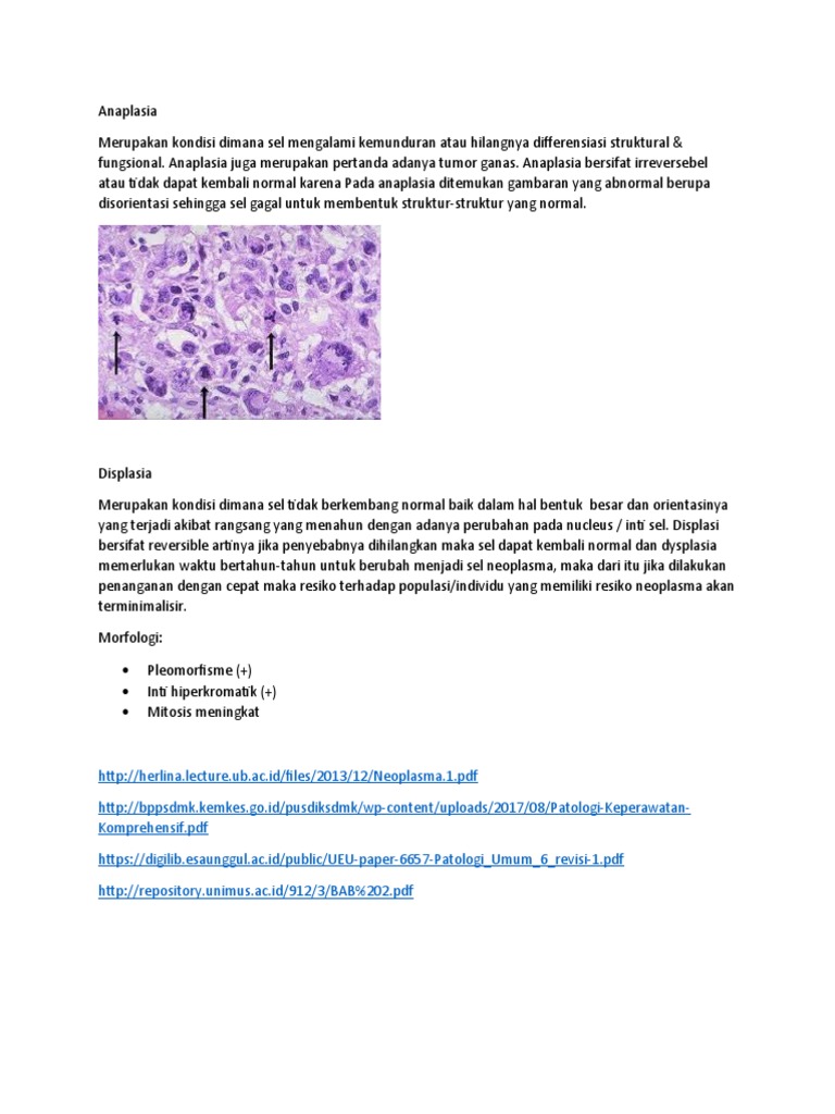 Anaplasia Materi | PDF