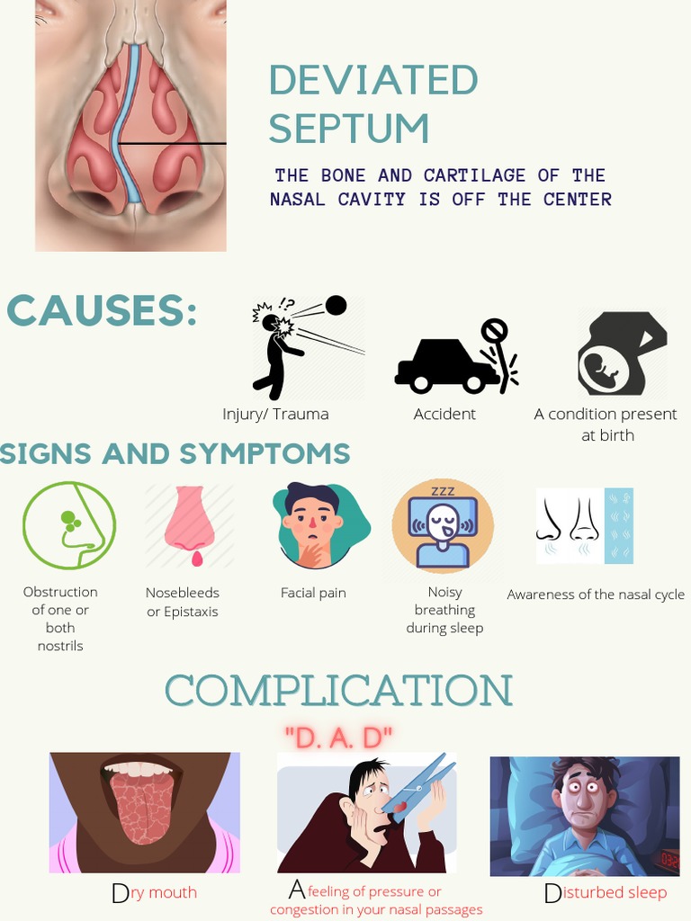 Deviated Septum | PDF