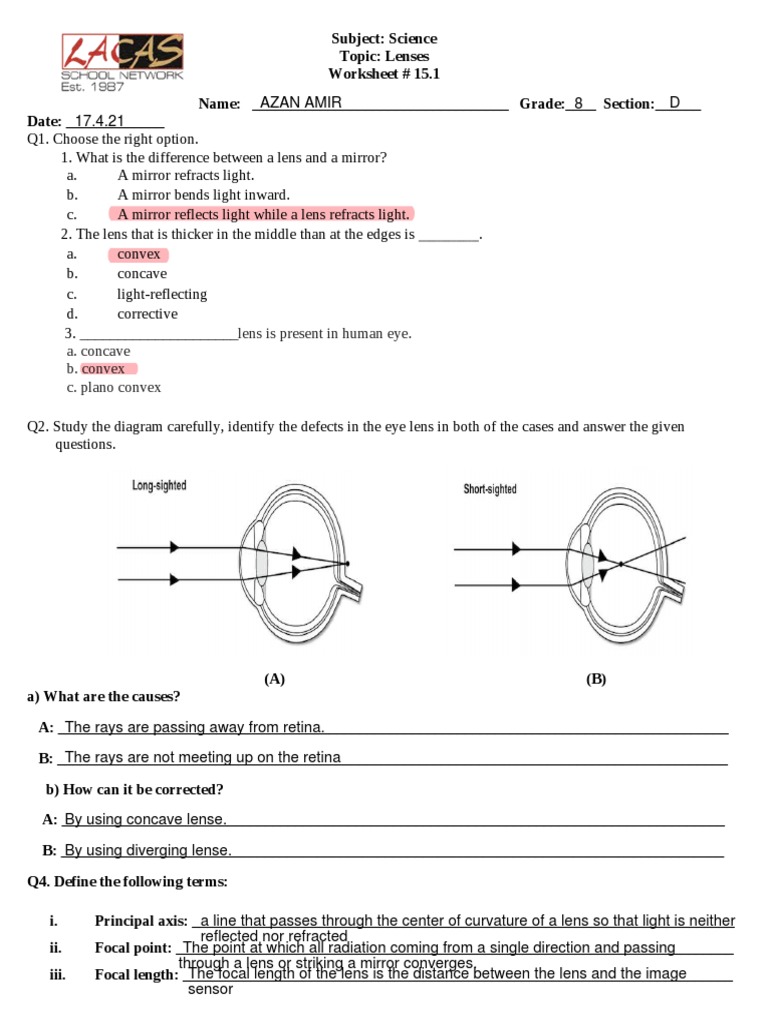 Lens Is Present in Human Eye. A. Concave B. Convex C. Plano Convex ...
