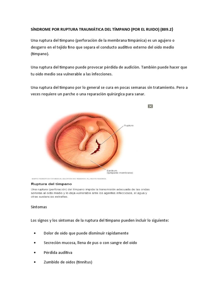 Ruptura del Tímpano: Causas y Síntomas | PDF | Oído | Tinnitus
