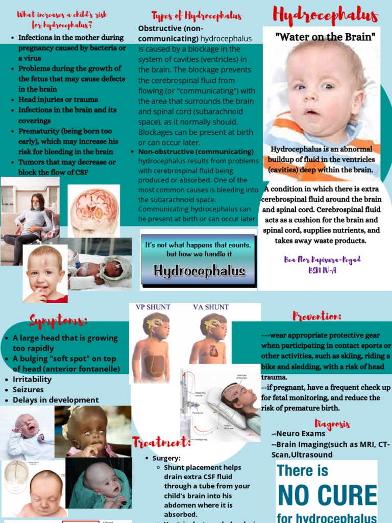 "Water On The Brain": Types of Hydrocephalus | PDF | Cerebrospinal ...