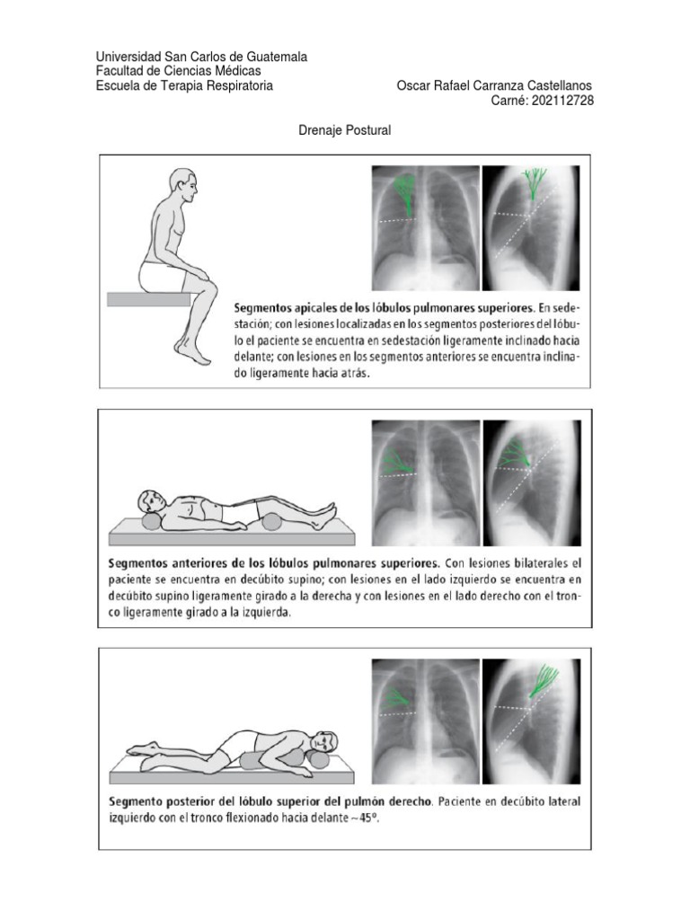 Drenaje Postural | PDF | Tórax | Tos