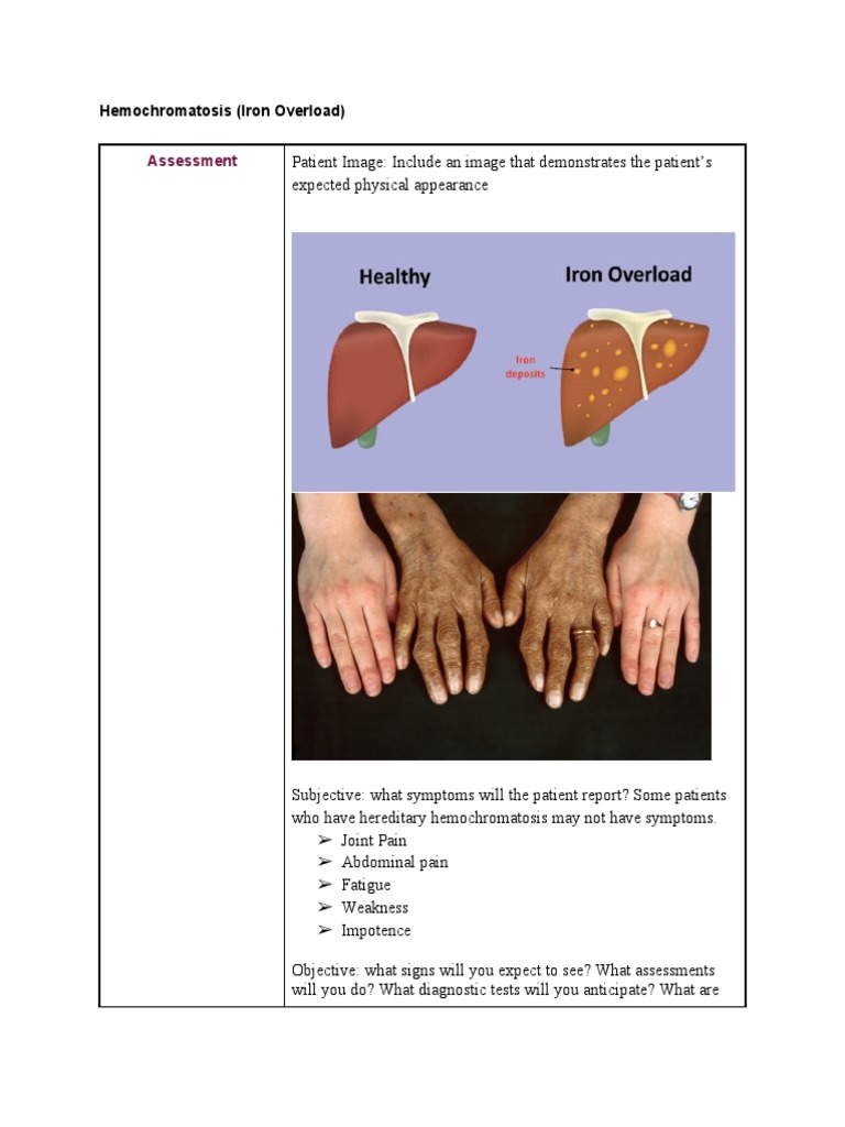 Assessment: Hemochromatosis (Iron Overload) | PDF | Medical Specialties ...